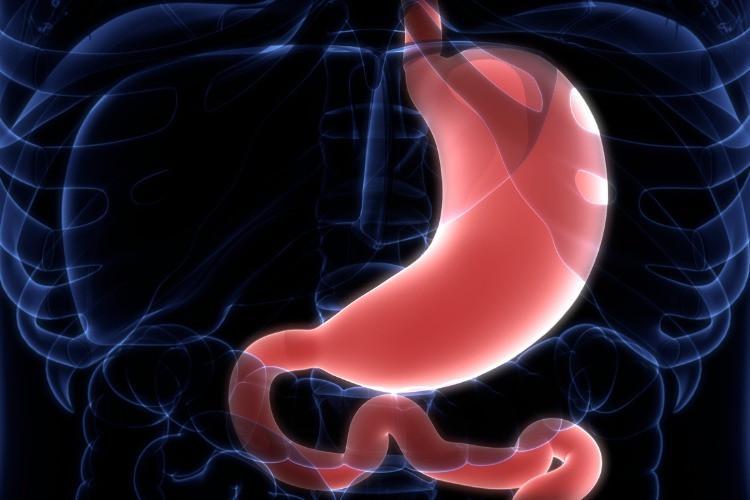 Gastrit Nedir, Neden Olur? Gastrit Belirtileri ve Tedavisi - Mahmure