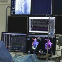 Circulatory system diseases remain leading cause of death in Türkiye ...