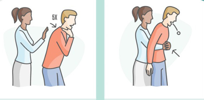 En önemli ilk yardım tekniklerinden... Heimlich manevrası nedir, nasıl ...
