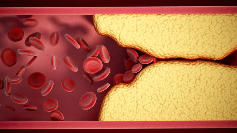 Ellerim ve ayaklarım neden bu kadar çok üşüyor? Bu sorunun cevabı basit ...