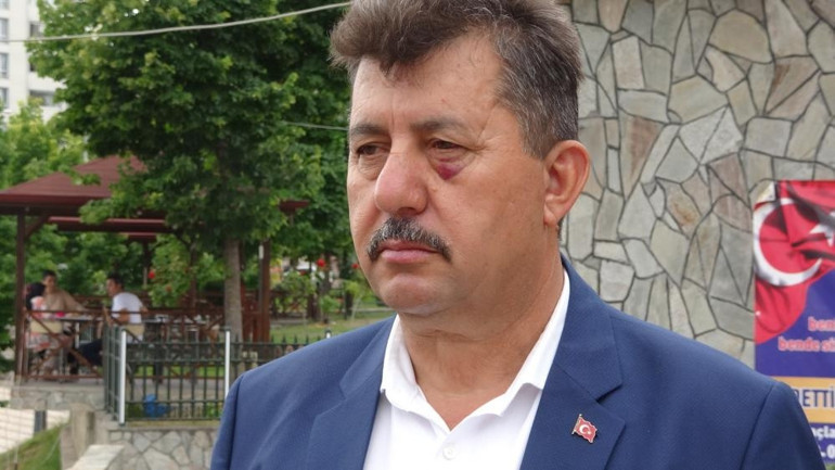 Parktaki çifti uyaran muhtar bıçaklandı: O anlar kamerada - Son Dakika ...